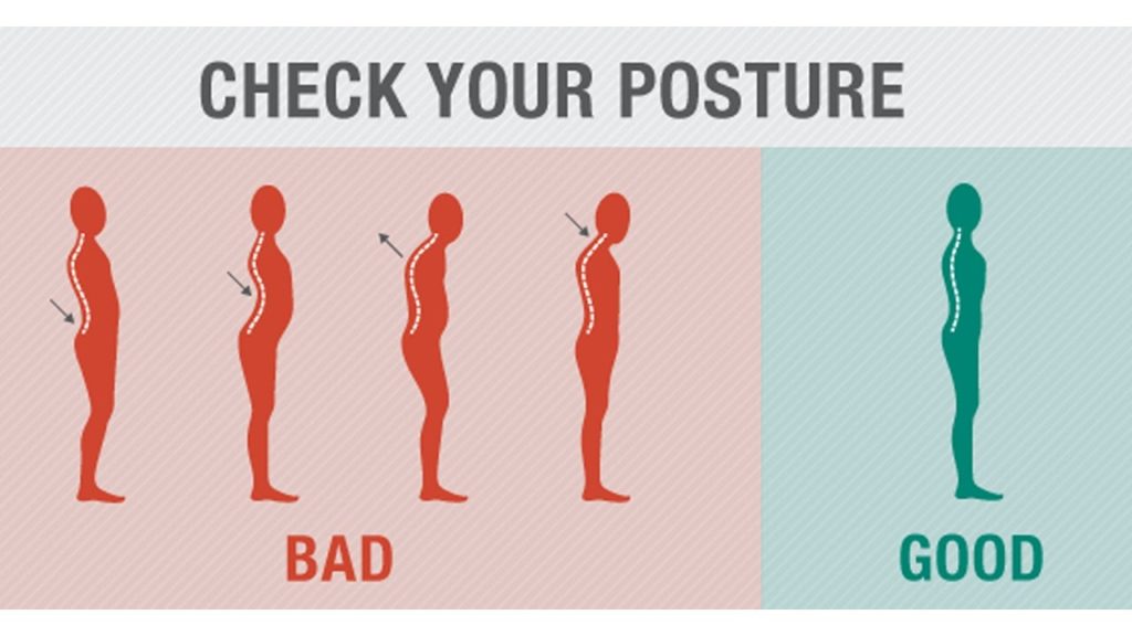 Posture And Postural Defects - ClassNotes.ng