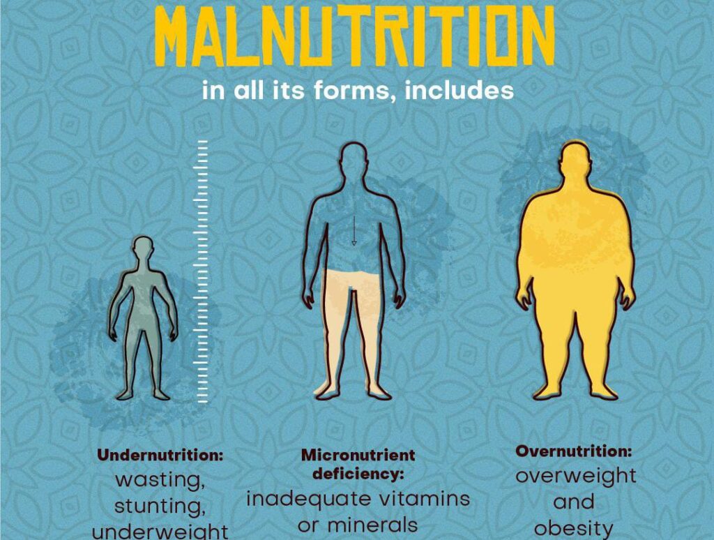 Deficiency and Malnutrition - Class Notes