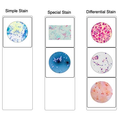 Simple, Differential, And Special Stains - ClassNotes.ng