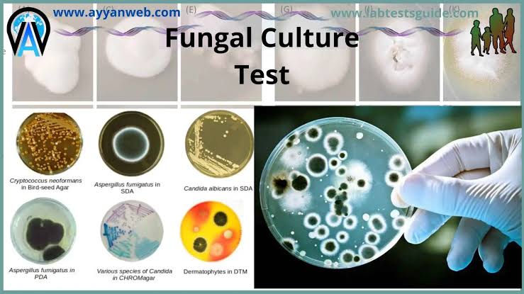 Culture Media For Fungi - ClassNotes.ng